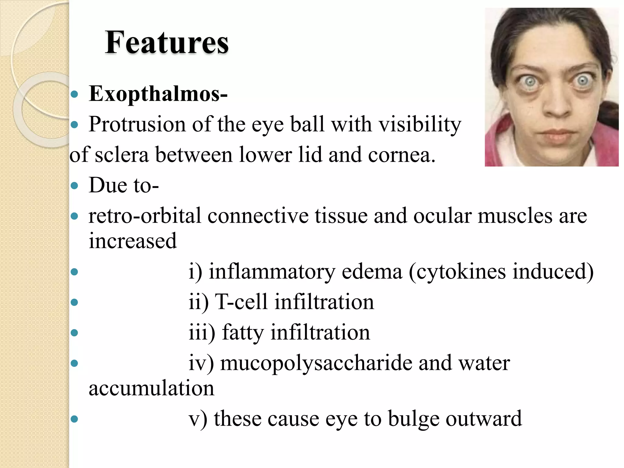 Thyroid Gland and Disease of Thyroid Gland | PPTX