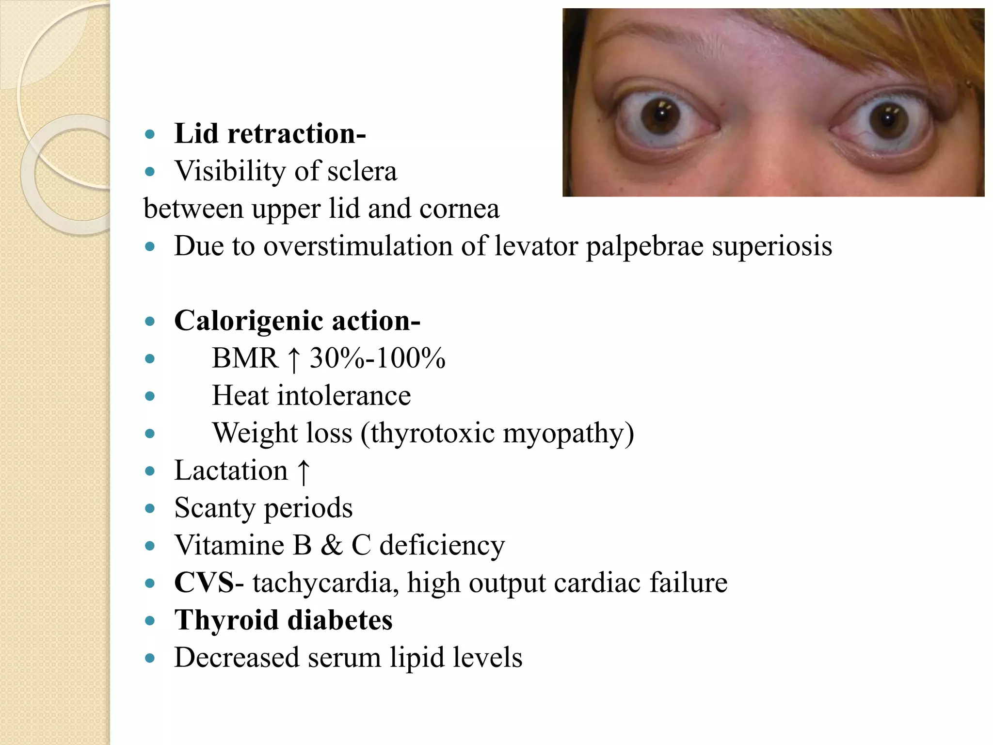 Thyroid Gland and Disease of Thyroid Gland | PPTX
