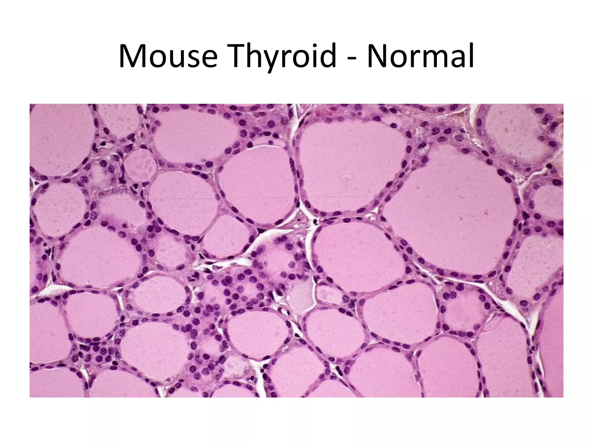 Neoplastic and Non-neoplastic Rodent Thyroid Lesions and Their ...