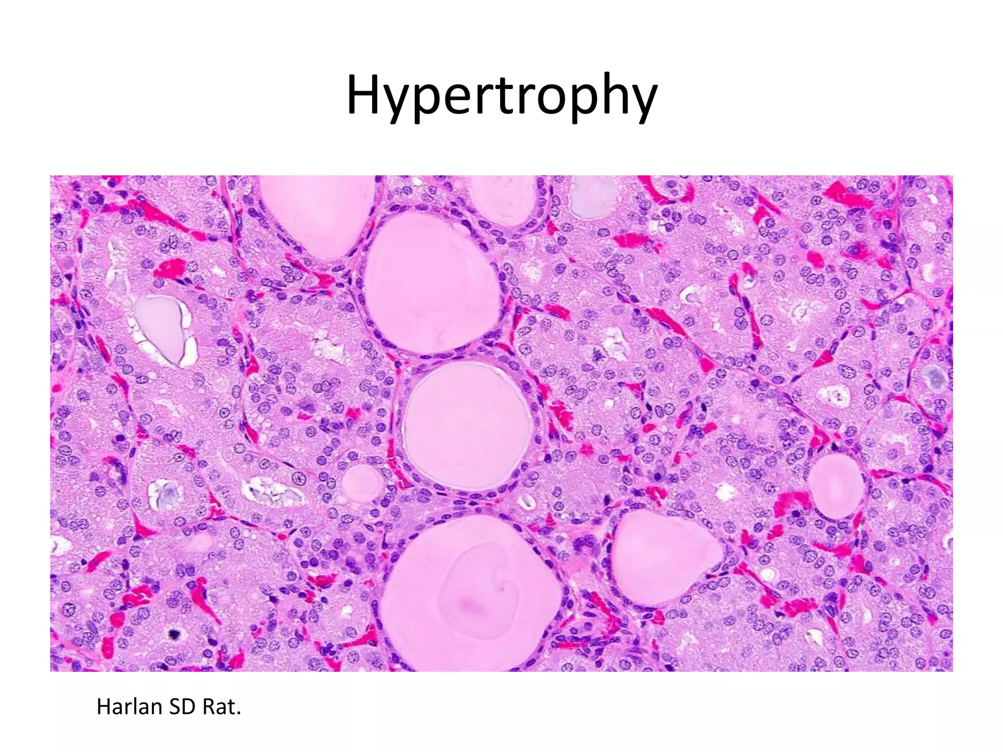 Neoplastic and Non-neoplastic Rodent Thyroid Lesions and Their ...
