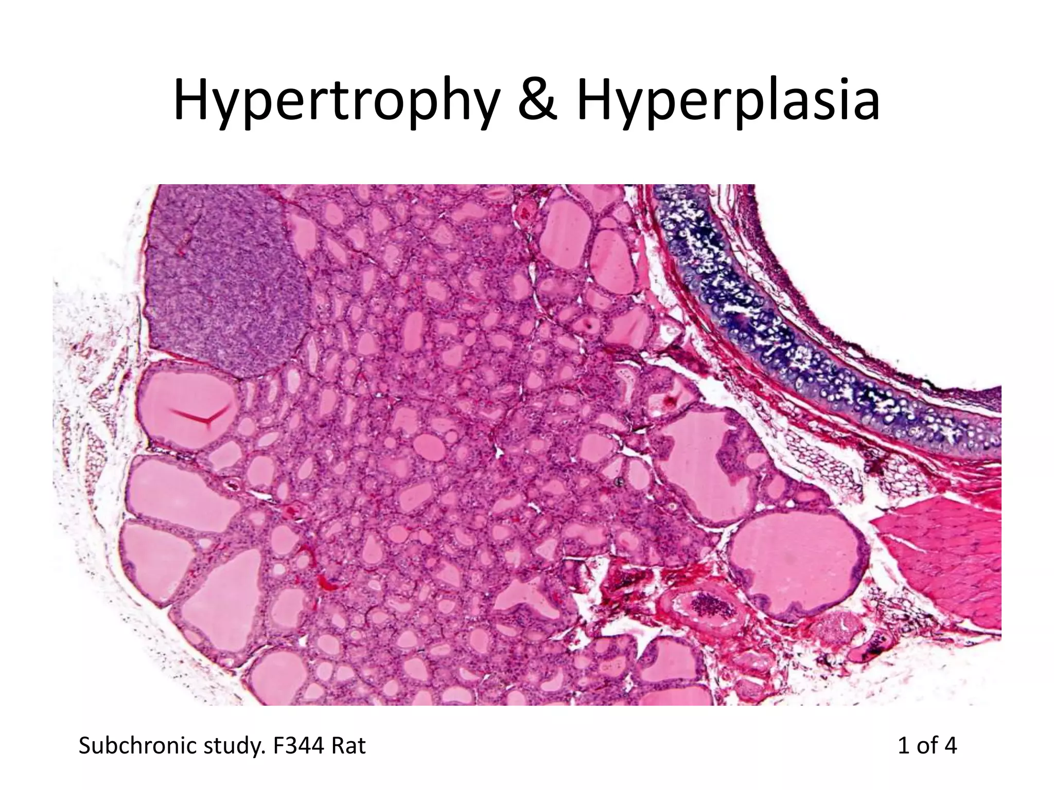 Neoplastic and Non-neoplastic Rodent Thyroid Lesions and Their ...