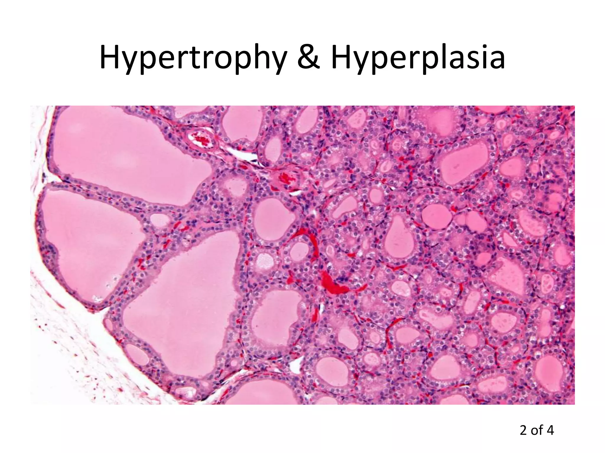 Neoplastic and Non-neoplastic Rodent Thyroid Lesions and Their ...