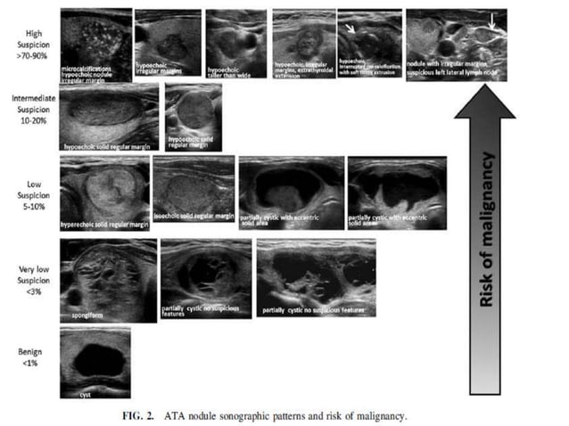Thyroid Slides 2 Pptx