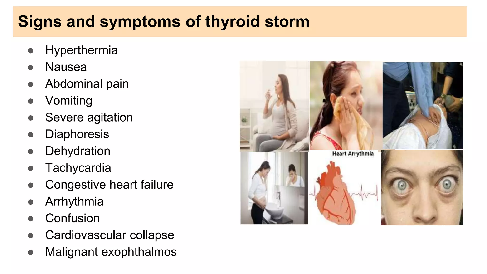 Thyroid storm Dr Yashodhara Gaur | PPTX