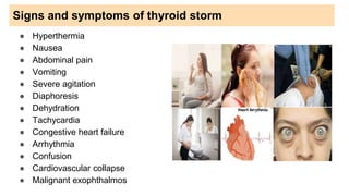 Thyroid storm Dr Yashodhara Gaur | PPT