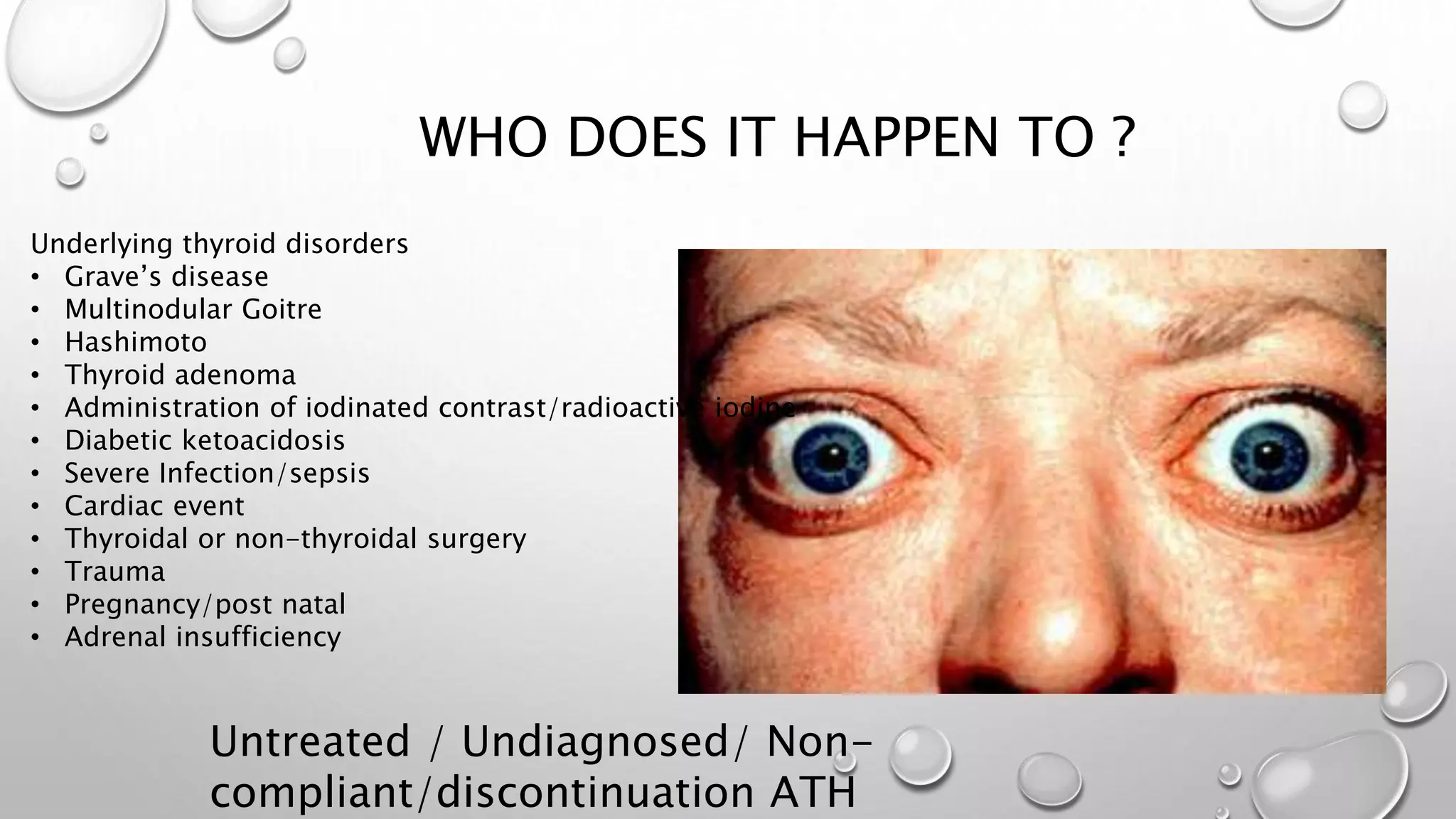 Thyroid storm | PPTX
