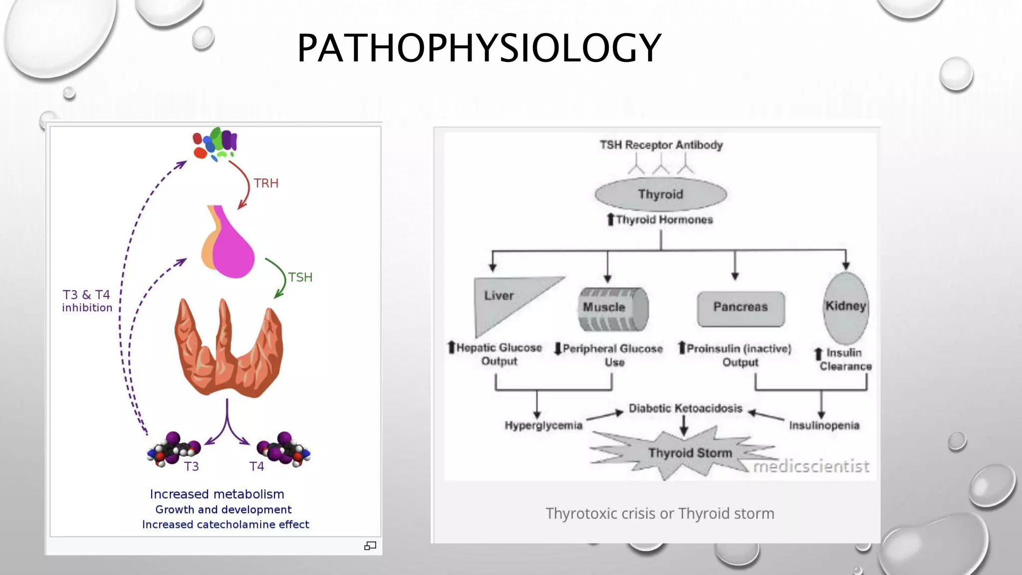 Thyroid storm | PPTX