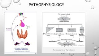 Thyroid storm | PPTX
