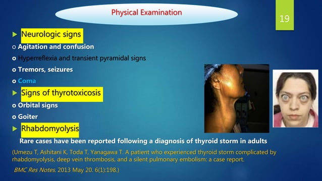 Thyroid storm final a | PPTX | Thyroid Disorders | Endocrine and Metabolic Diseases