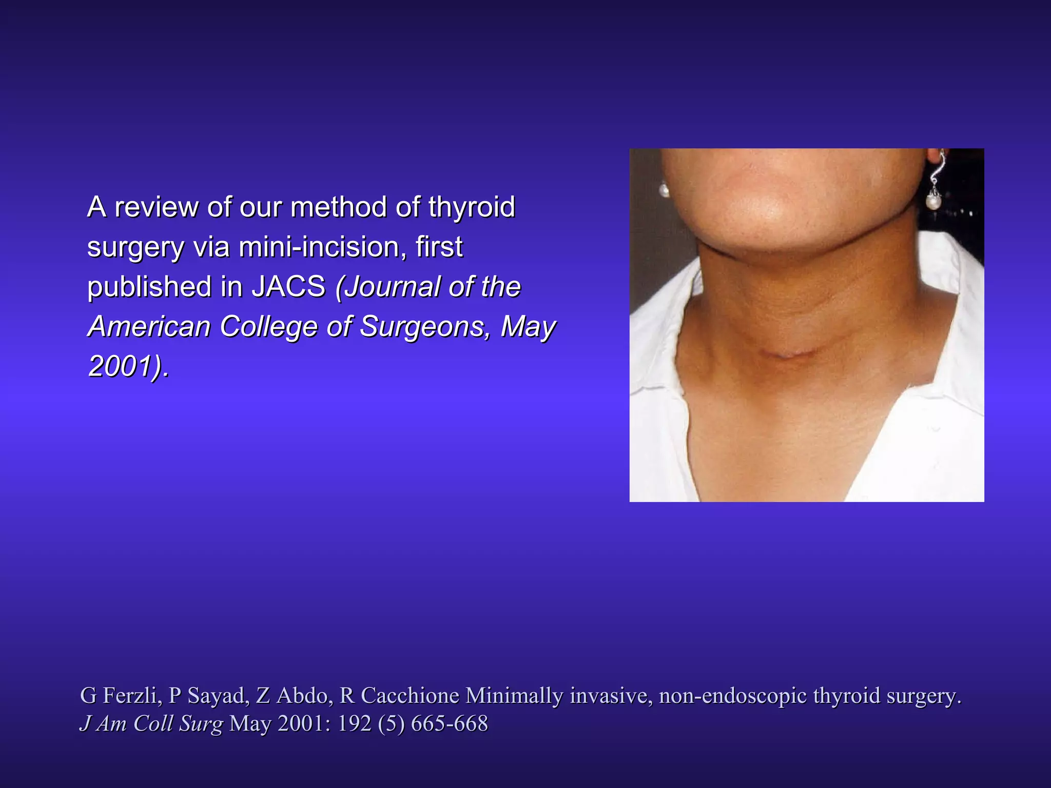Thyroid Surgery by Mini-incision | PPT