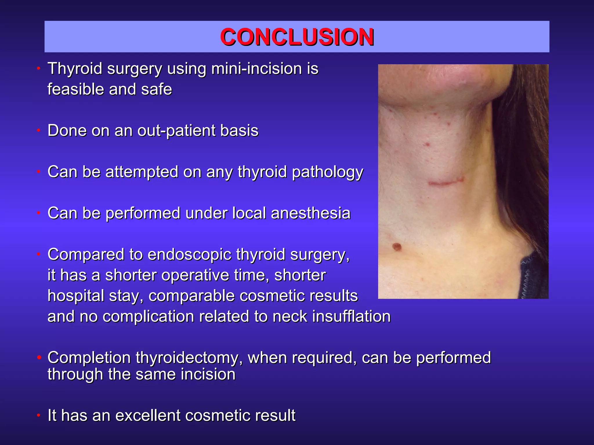 Thyroid Surgery by Mini-incision | PPT