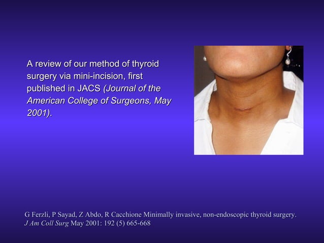 Thyroid Surgery by Mini-incision | PPT