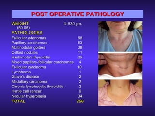 Thyroid Surgery by Mini-incision | PPT