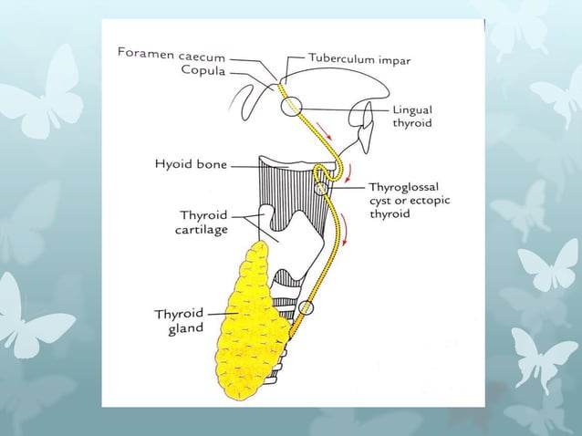 Thyroid surgical anatomy | PPTX | Thyroid Disorders | Endocrine and ...