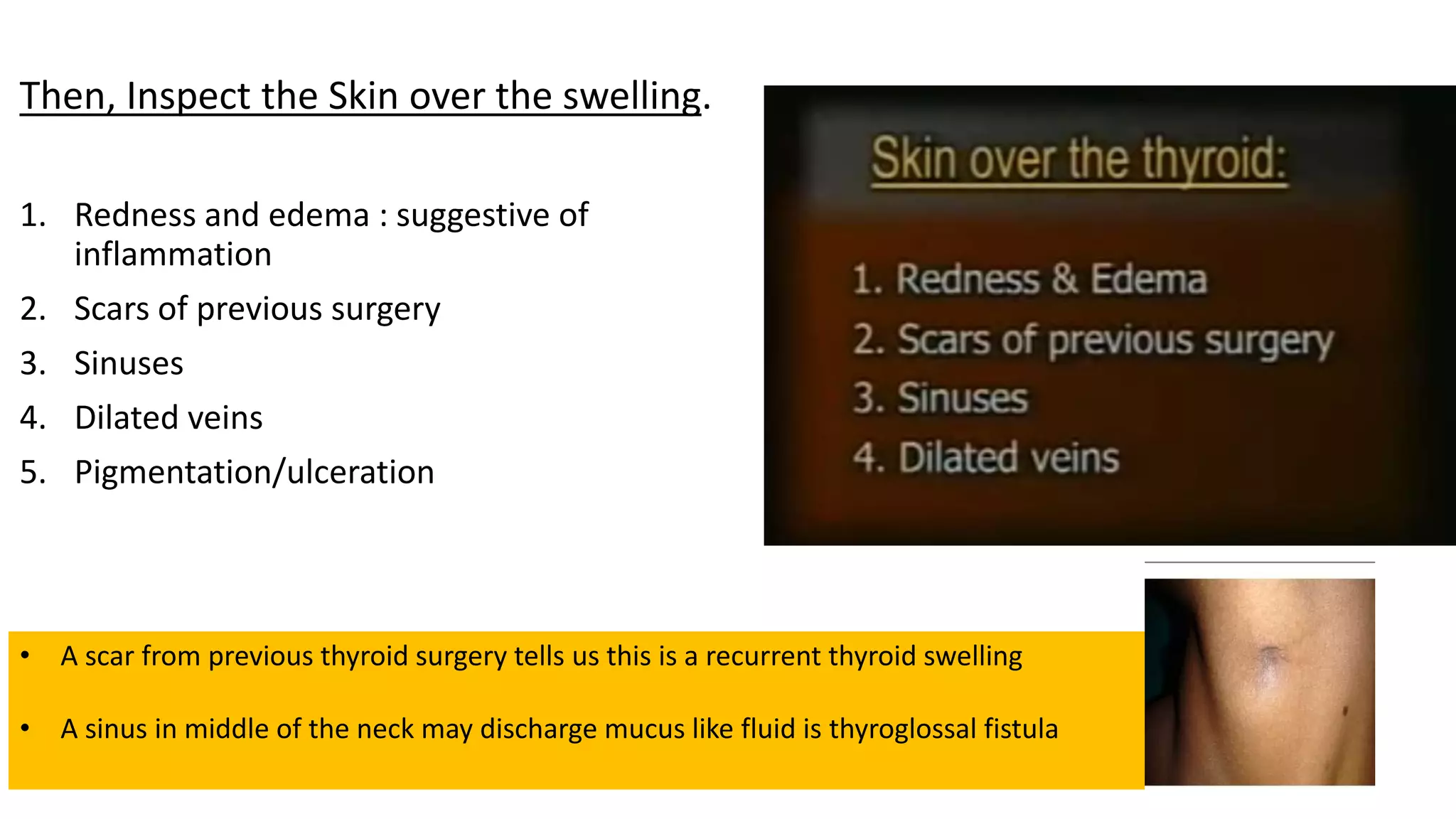 Thyroid Examination - General Surgery | PPTX