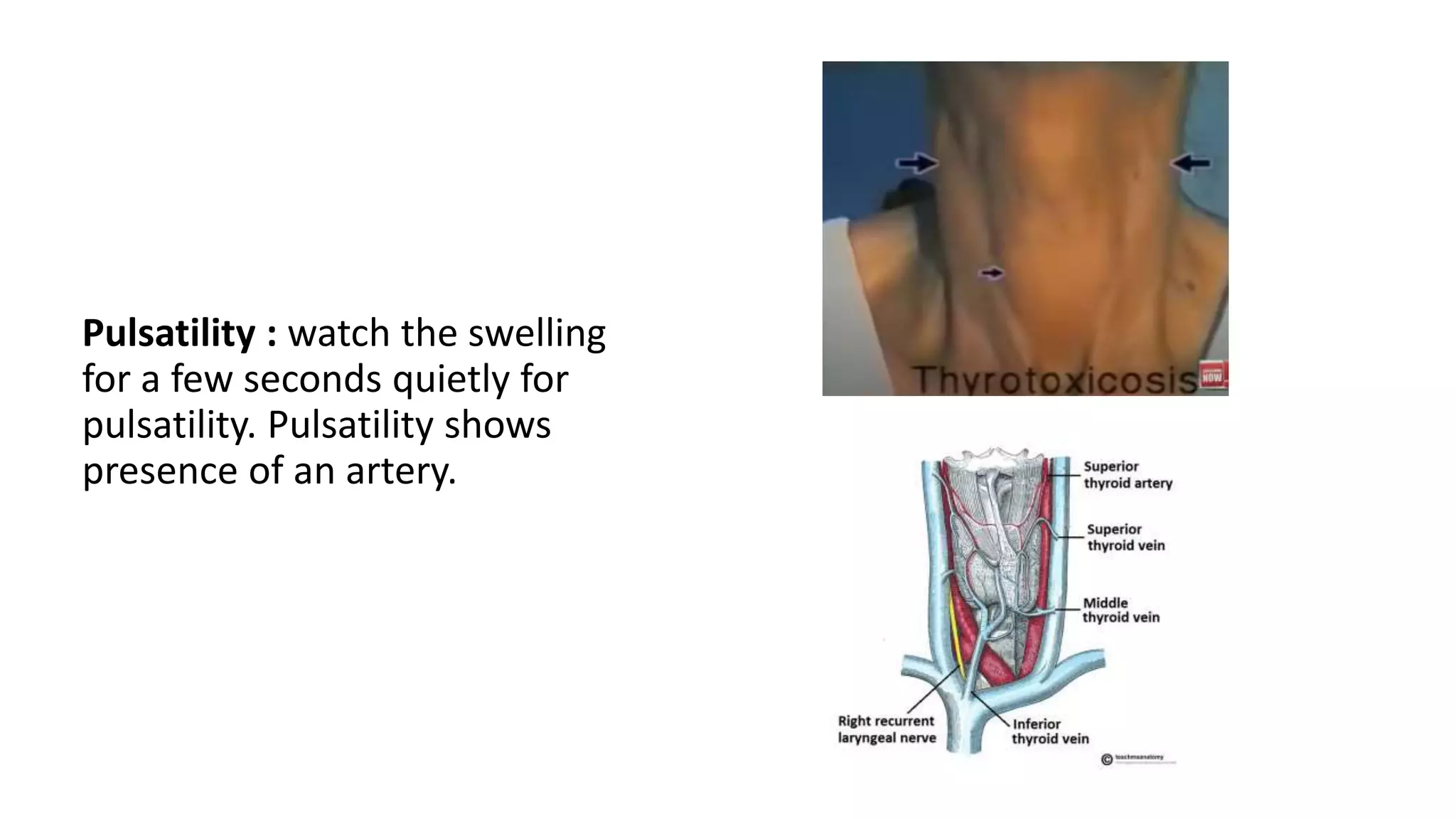 Thyroid Examination - General Surgery | PPTX