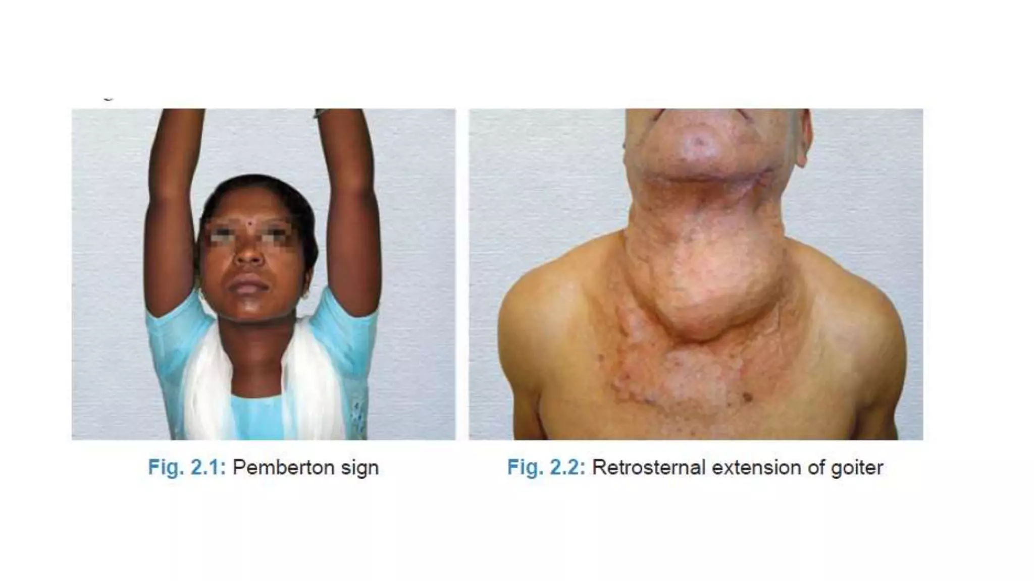 Thyroid Examination - General Surgery | PPTX