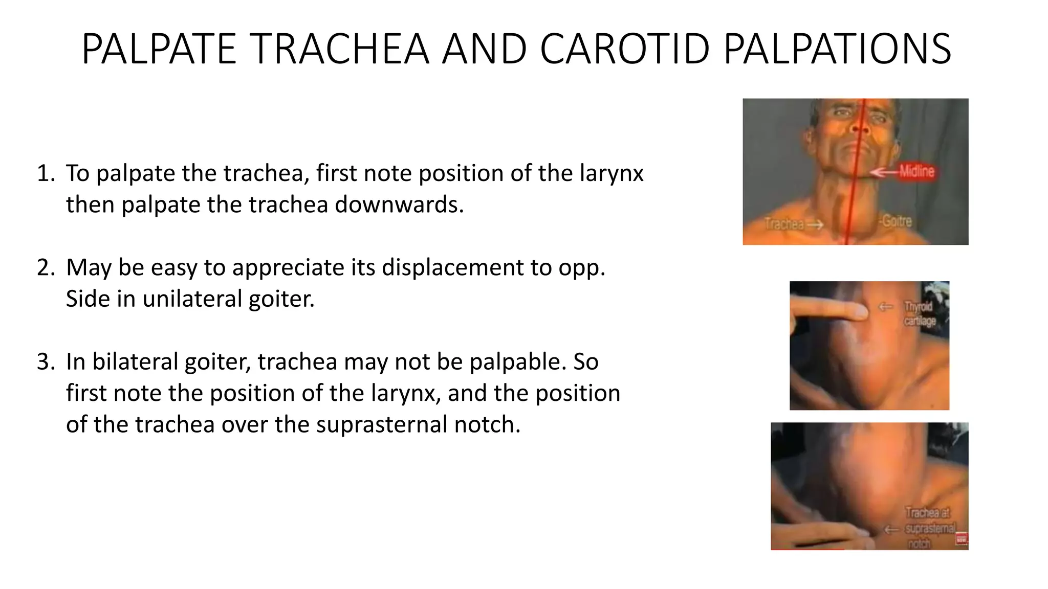 Thyroid Examination - General Surgery | PPTX
