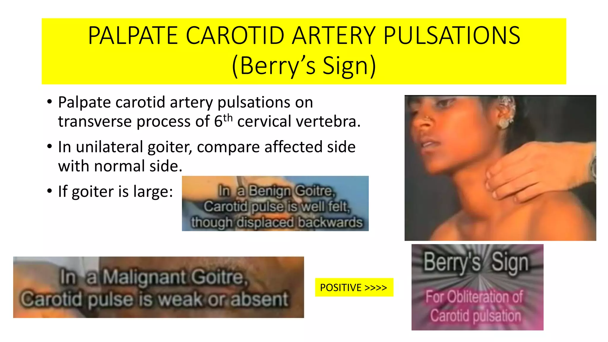 Thyroid Examination - General Surgery | PPTX