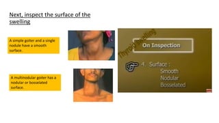 Thyroid Examination - General Surgery | PPTX