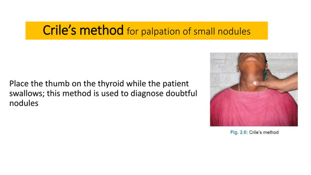 Thyroid Examination - General Surgery | PPTX
