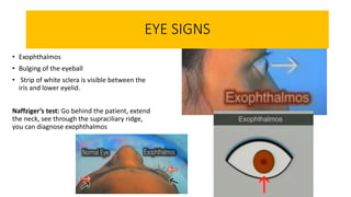 Thyroid Examination - General Surgery | PPTX