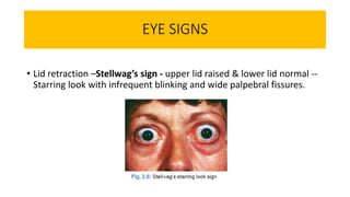 Thyroid Examination - General Surgery | PPT