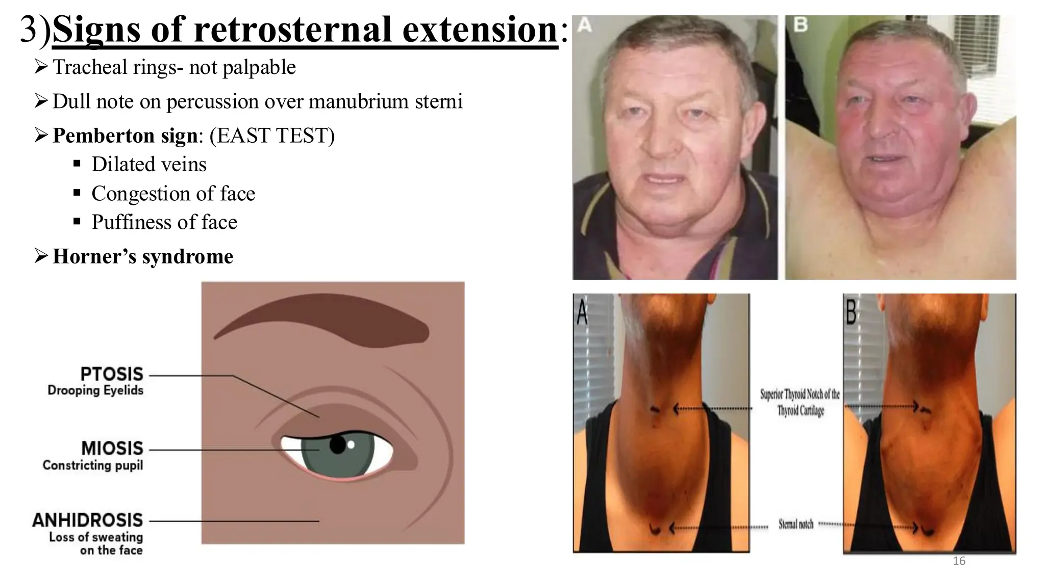 Thyroid swelling-clinical examination.pdf