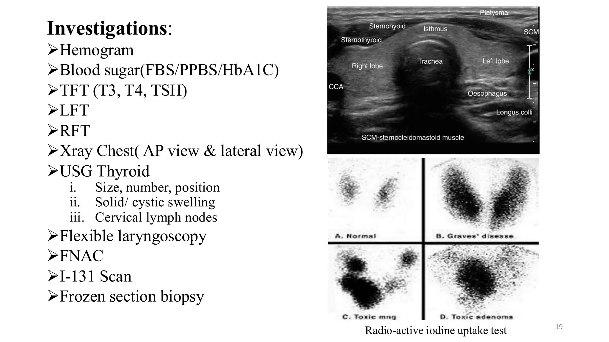 Thyroid swelling-clinical examination.pdf