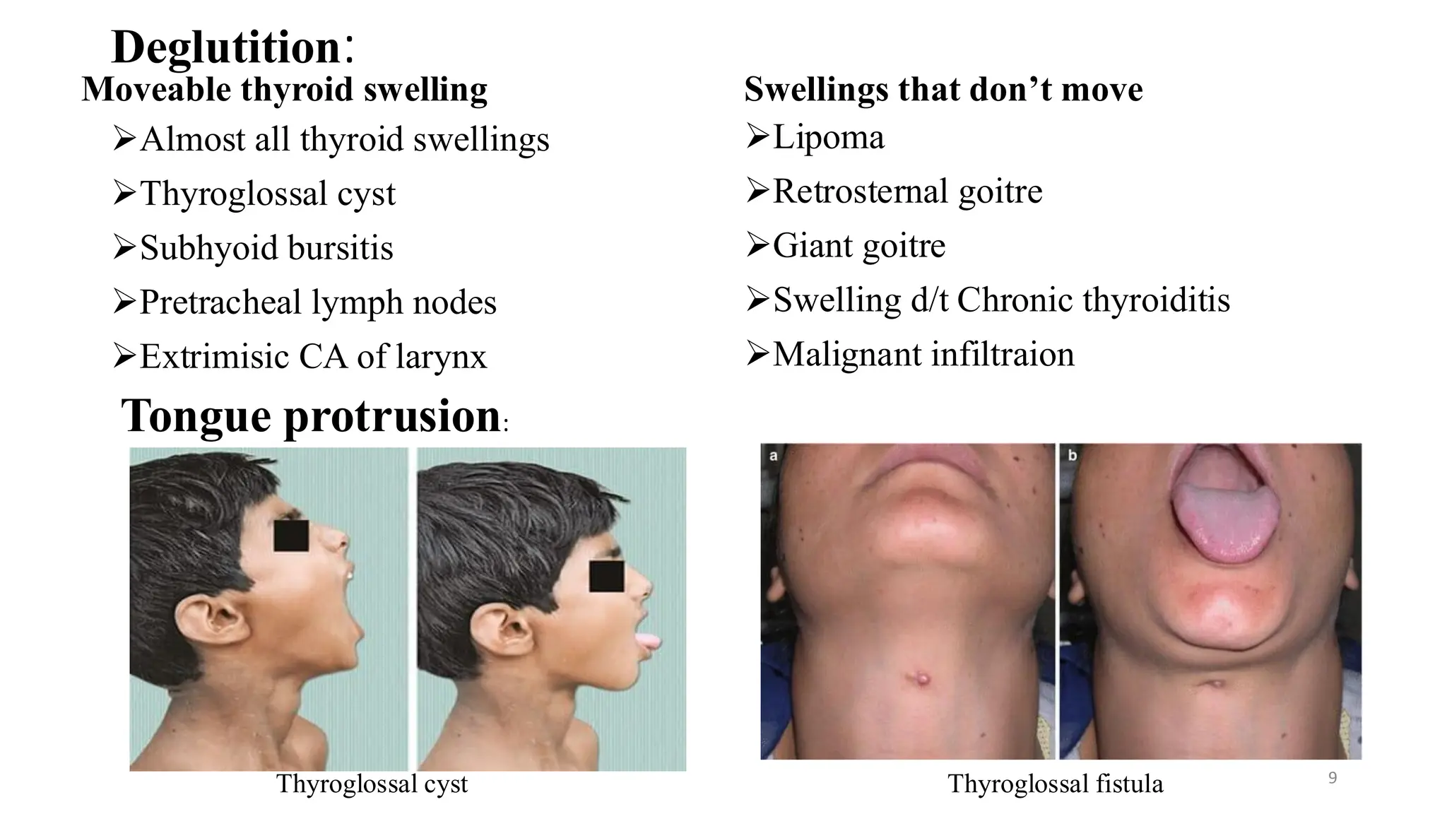 Thyroid swelling-clinical examination.pdf