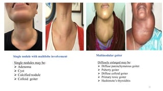 Thyroid swelling-clinical examination.pdf