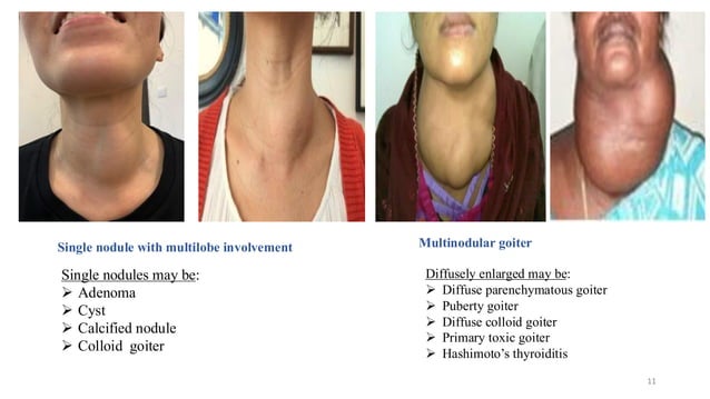 Thyroid swelling-clinical examination.pdf