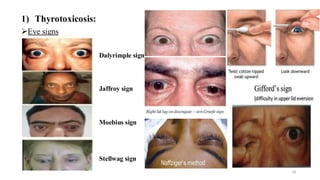 Thyroid swelling-clinical examination.pdf