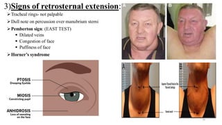 Thyroid swelling-clinical examination.pdf