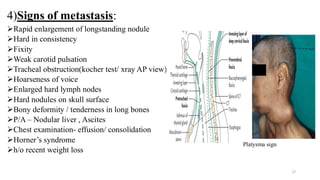 Thyroid swelling-clinical examination.pdf