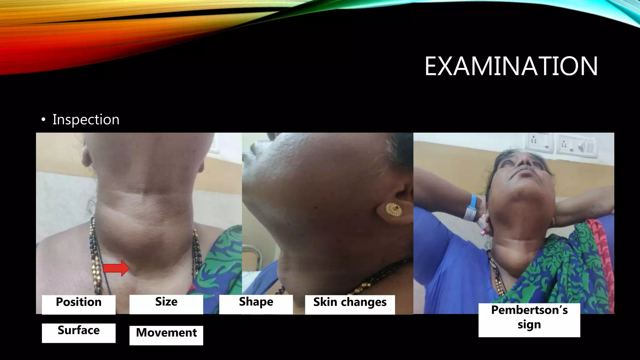 Thyroid swelling and its management | PPTX