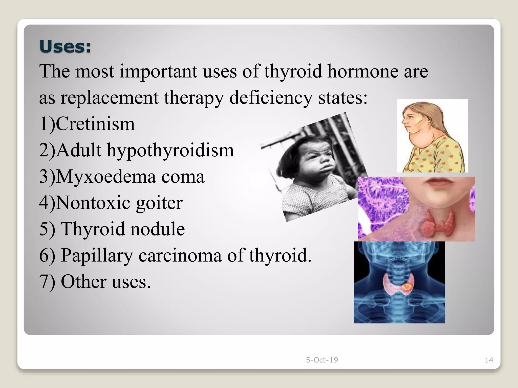 Thyroid & antithyroid drug | PPTX