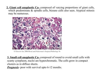 Thyroid tumors, tumor markers, causes,clinical | PPTX