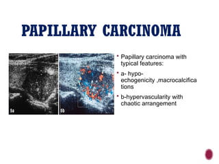 THYROID ULTRASOUND for master student class | PPTX