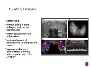 THYROID ULTRASOUND for master student class | PPTX