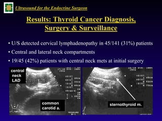 Thyroid Ultrasound For The Endocrine Surgeon | PDF