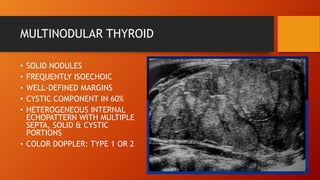 THYROID ULTRASOUND presentation.pptx