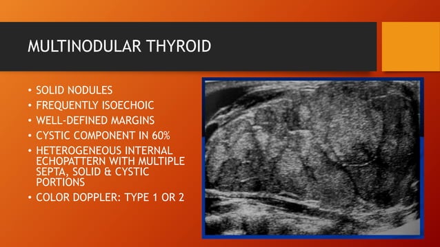 Thyroid Ultrasound Presentationpptx