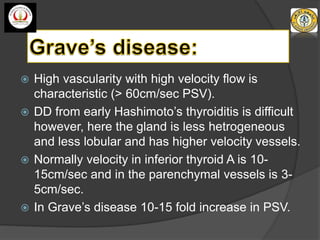 Thyroid us | PPTX