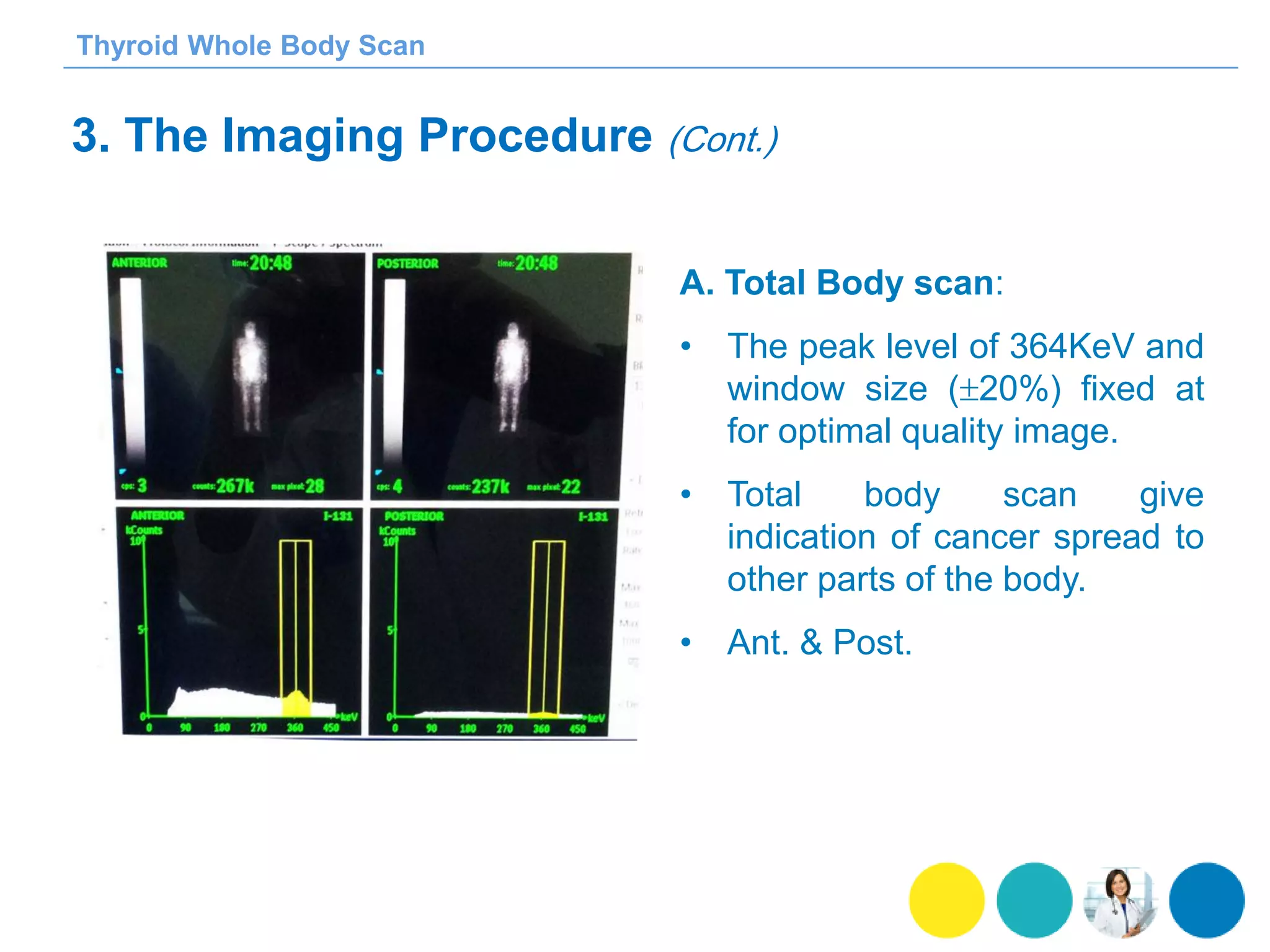Thyroid whole body scan | PDF