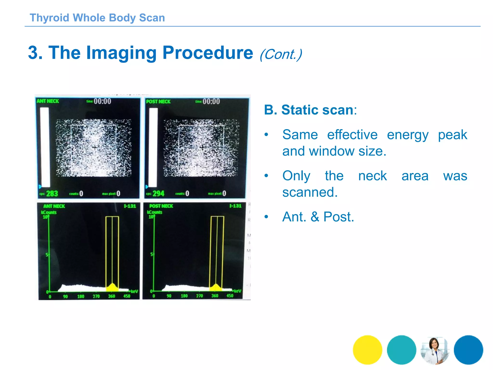 Thyroid whole body scan | PDF