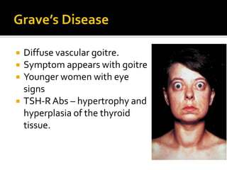 Thyrotoxicosis | PPTX