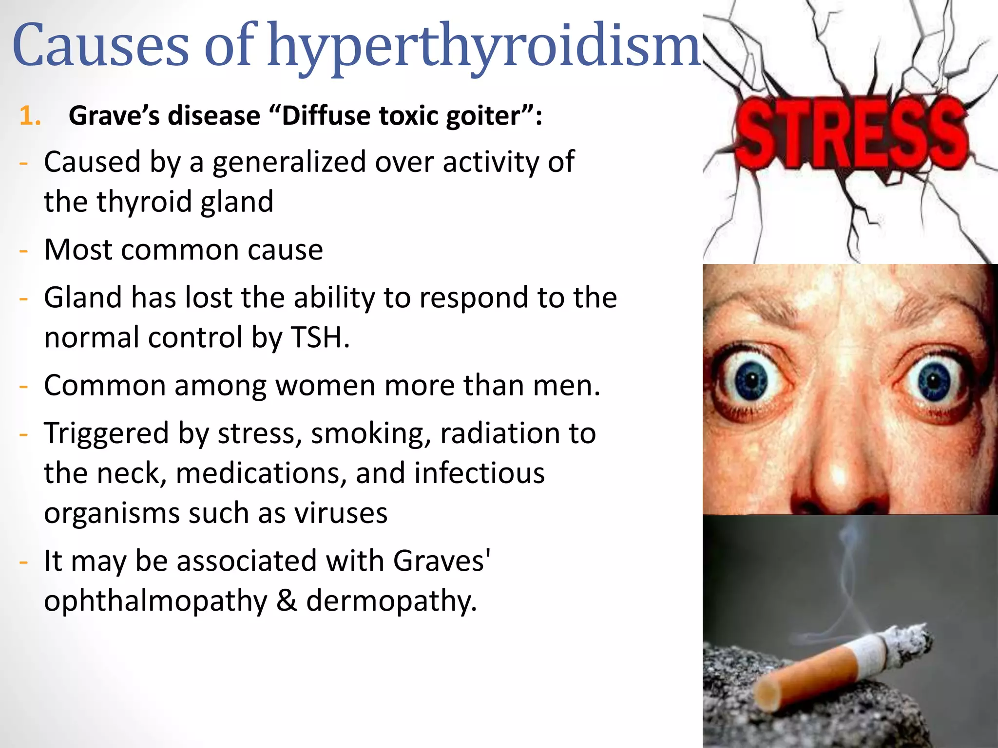 Thyrotoxicosis | PPTX
