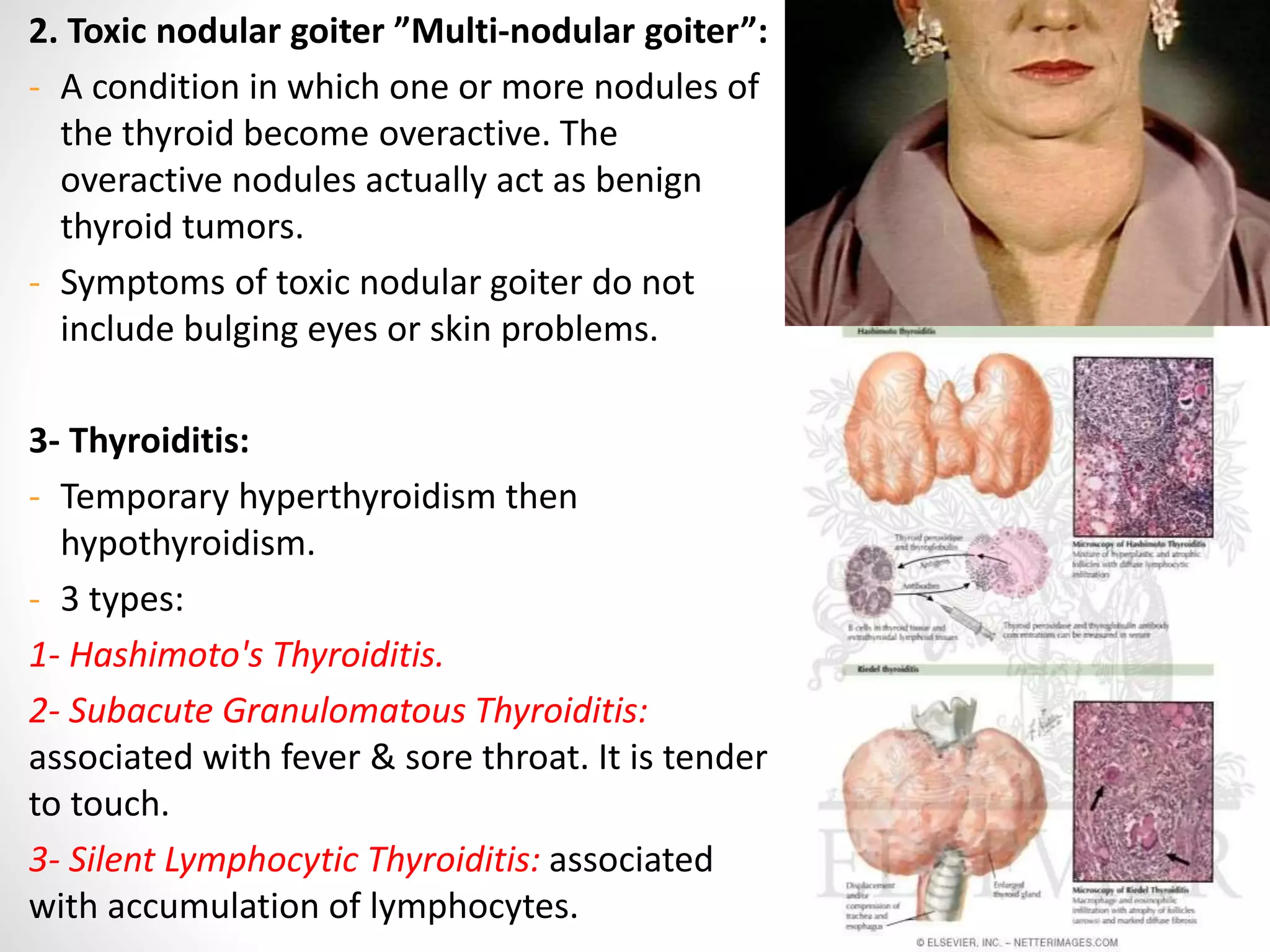 Thyrotoxicosis | PPTX
