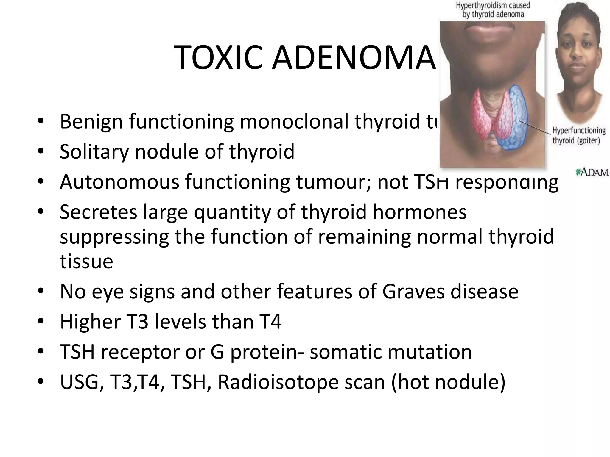Thyrotoxicosis- complete review of anatomy, physiology, types and ...